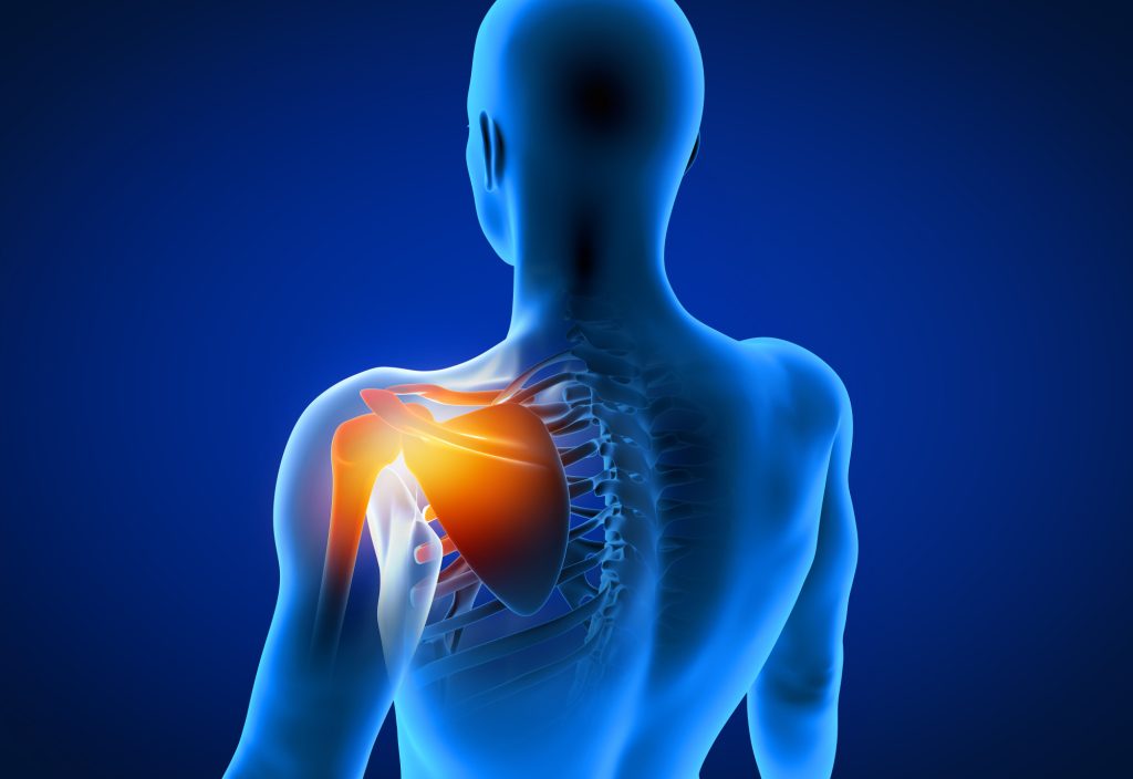 Shoulder in Bridgetown, Christ Church Barbados | Optimum Orthopaedics